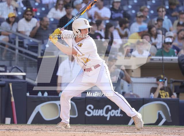 Photo 144 in the CIF SDS All-Star Game Photo Gallery (396 Photos)