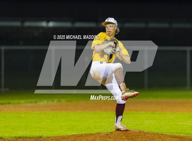 “Dylan Mills: A Living Miracle of Resilience, Strength, and Unbreakable ...